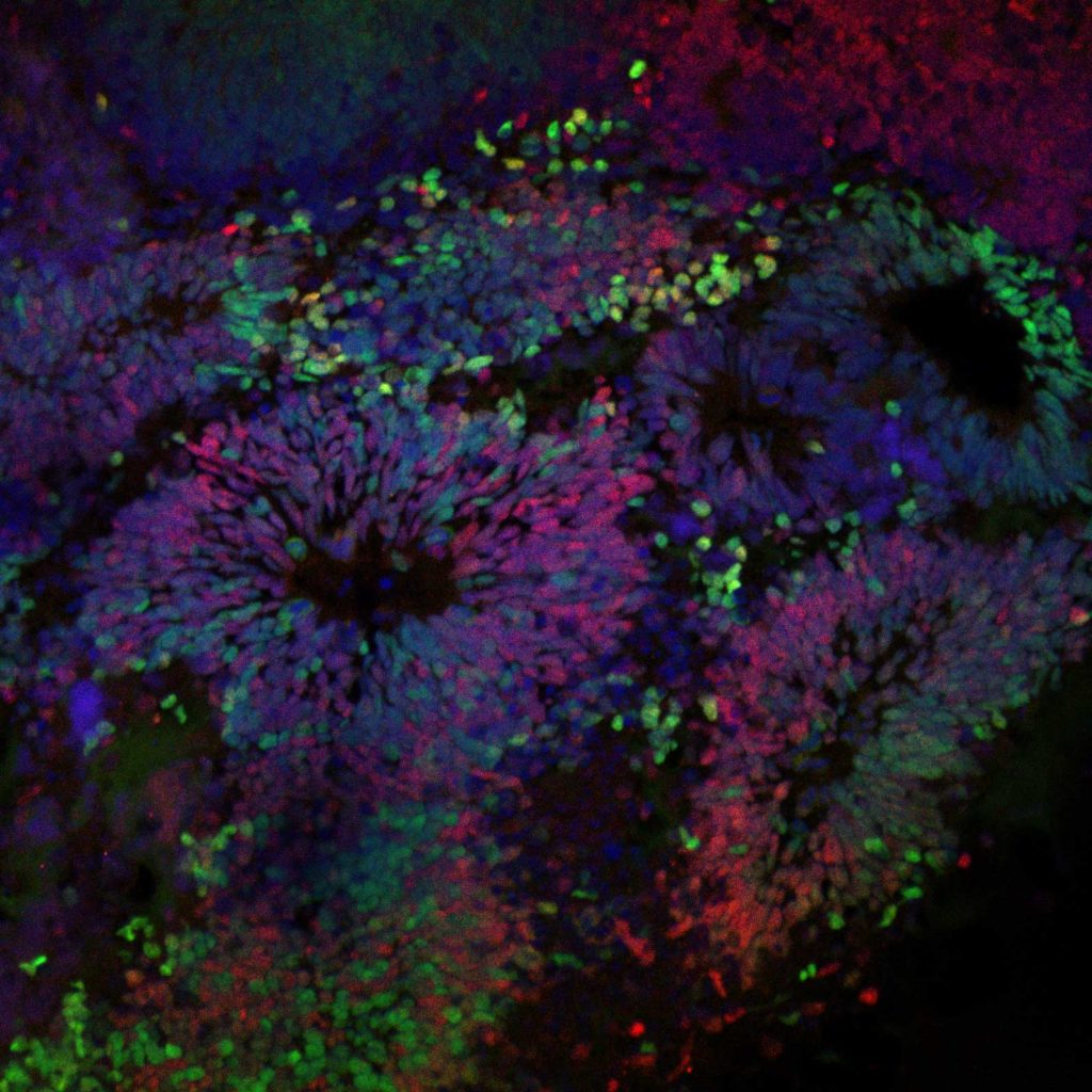 IPSC and organoid models for unravelling brain disease mechanisms ...